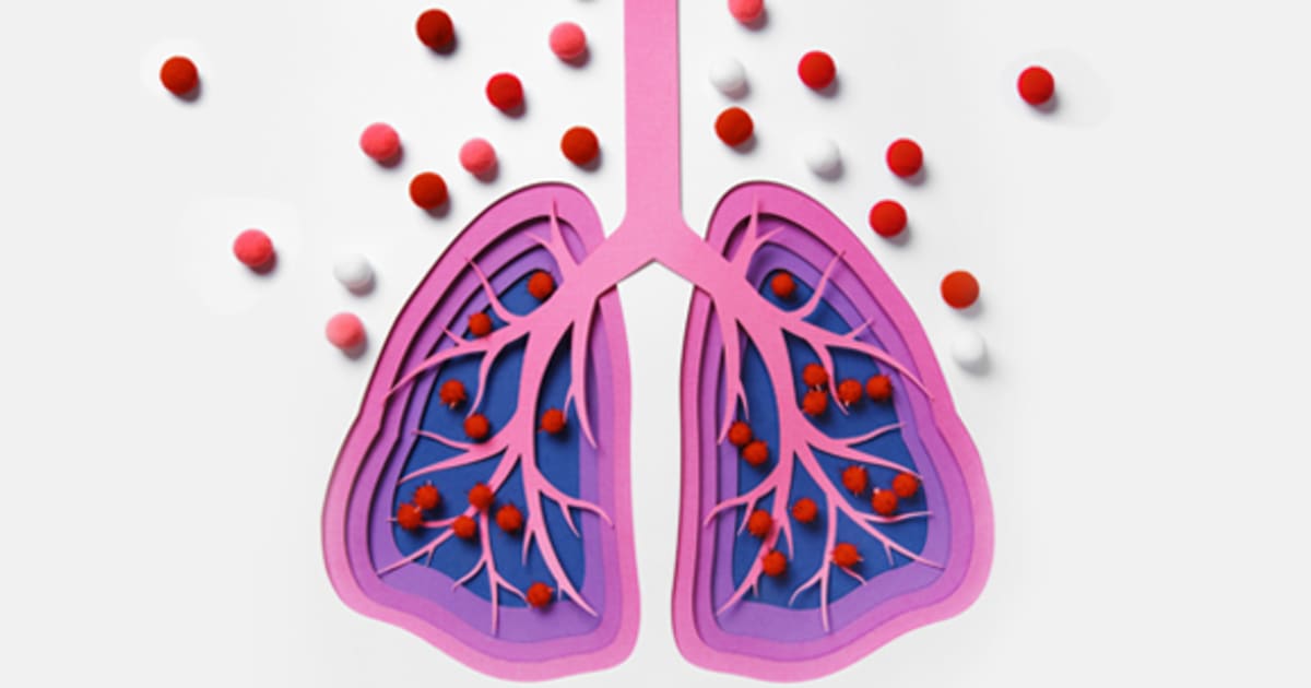 Symptoms of pneumonia | Baptist Health | Jacksonville, FL
